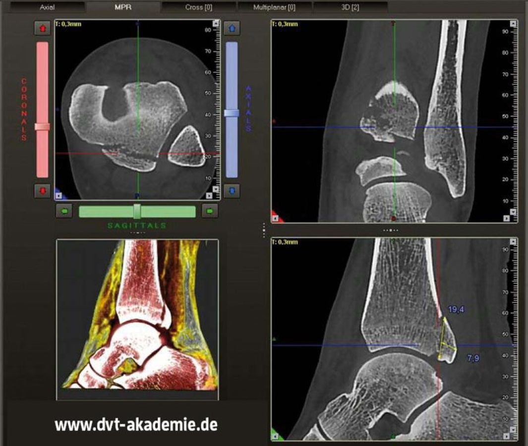 DVT-Röntgen in der Orthopädie - NEUE KURSE 2019/2020