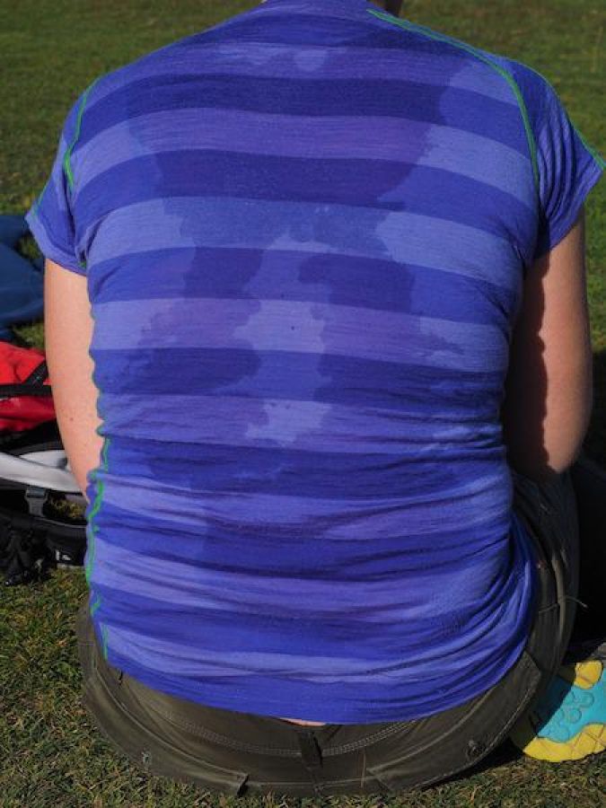 A.S.thetics - Dr. Adam Stanek: Hyperhidrose – Wenn extremes Schwitzen ...