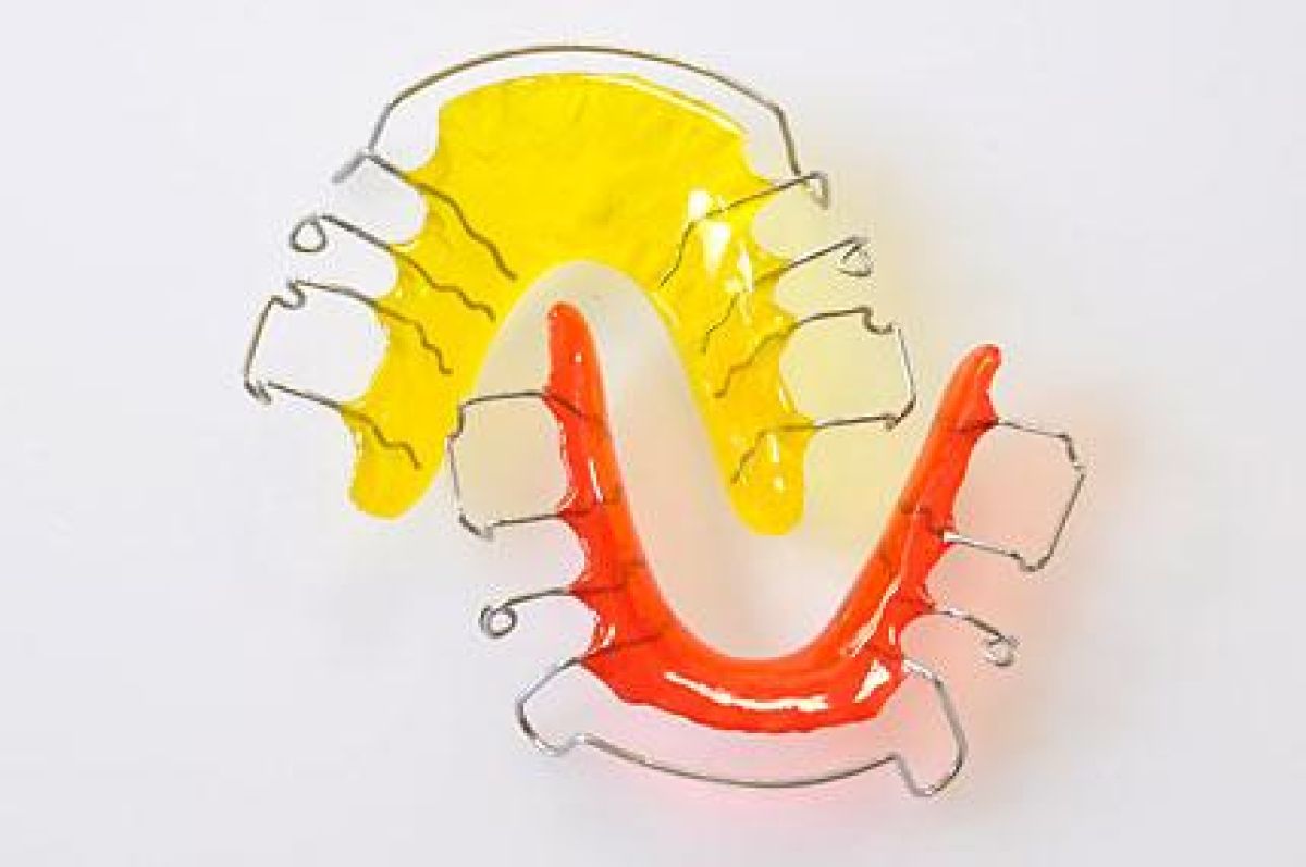 Platzhalter in der Kieferorthopädie