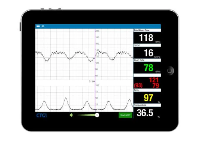 CTGi von iSimulate: Weltweit erste Kardiotokografie-Simulation auf iPad-Basis